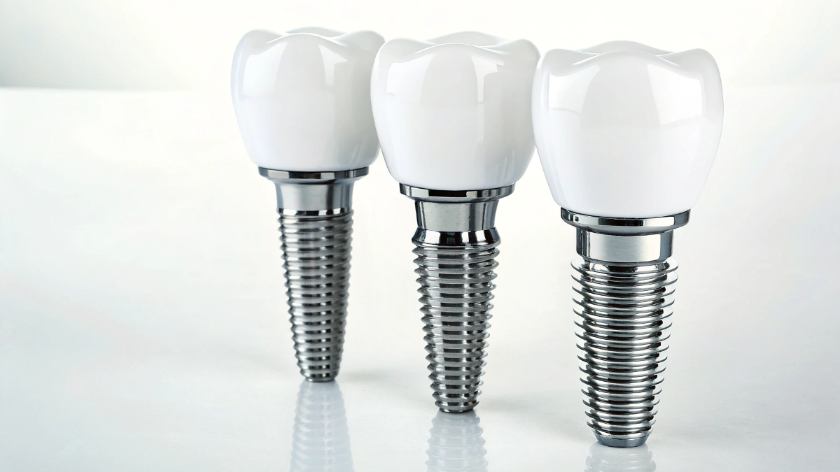 What are Hybridge Dental Implants? | Revitalize Dental